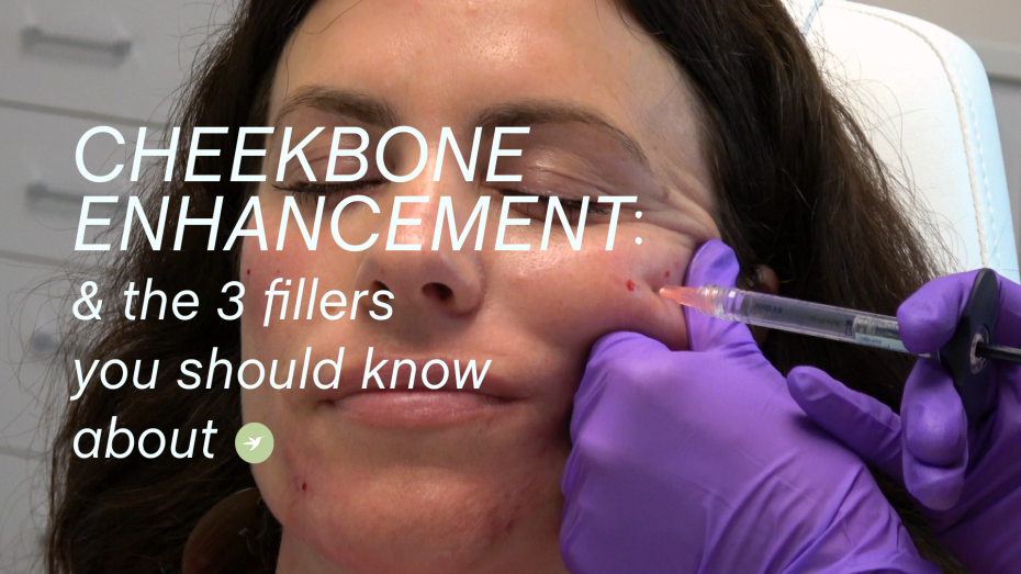 Cheek Fillers Juvederm Voluma Restylane Lyft And Sculptra Skin By Lovely