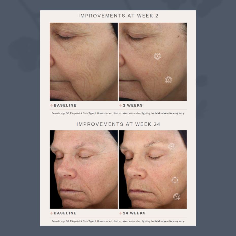 What’s New with TNS Advanced+ Serum - Skin by Lovely