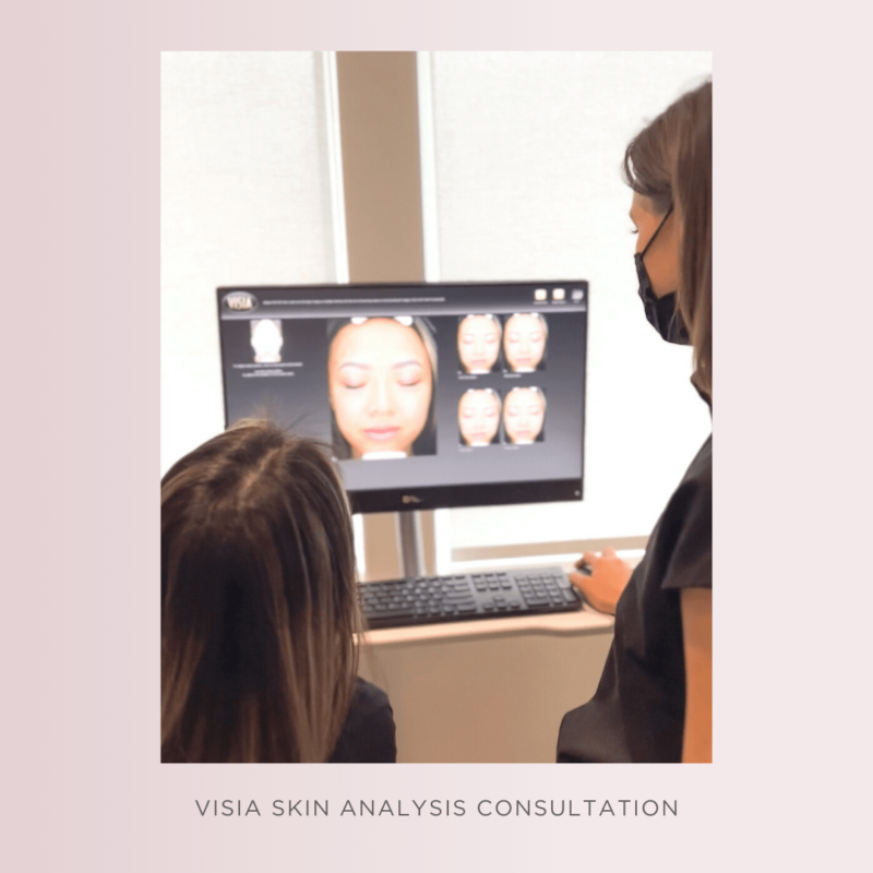 9 Things To Know About the Visia Skin Analysis - Skin by Lovely