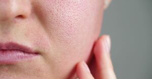 A Look at 10 Important Signs of Damaged Skin